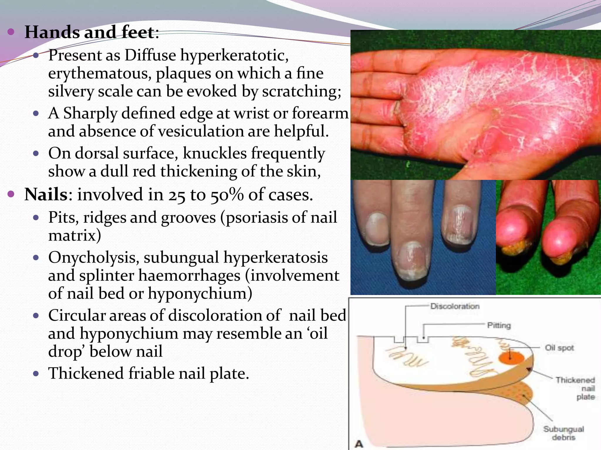Seminar clinical approach to papulosqamous disorders. | PPTX