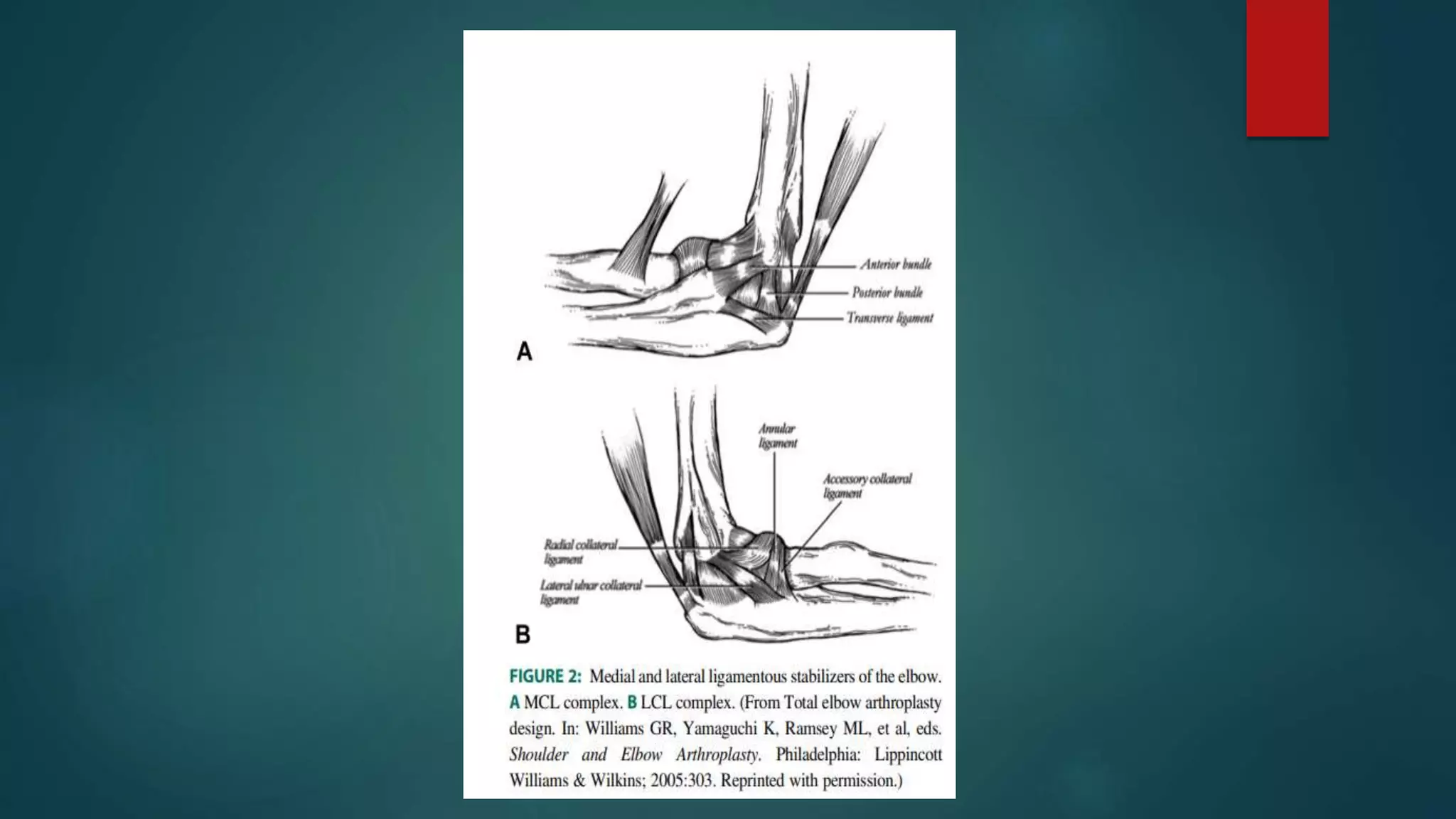 Deformities around elbow and management | PPTX