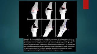Deformities around elbow and management | PPTX