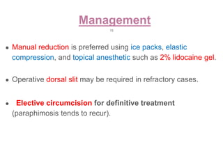 seminar urology pediatric for inguinal and | PPTX