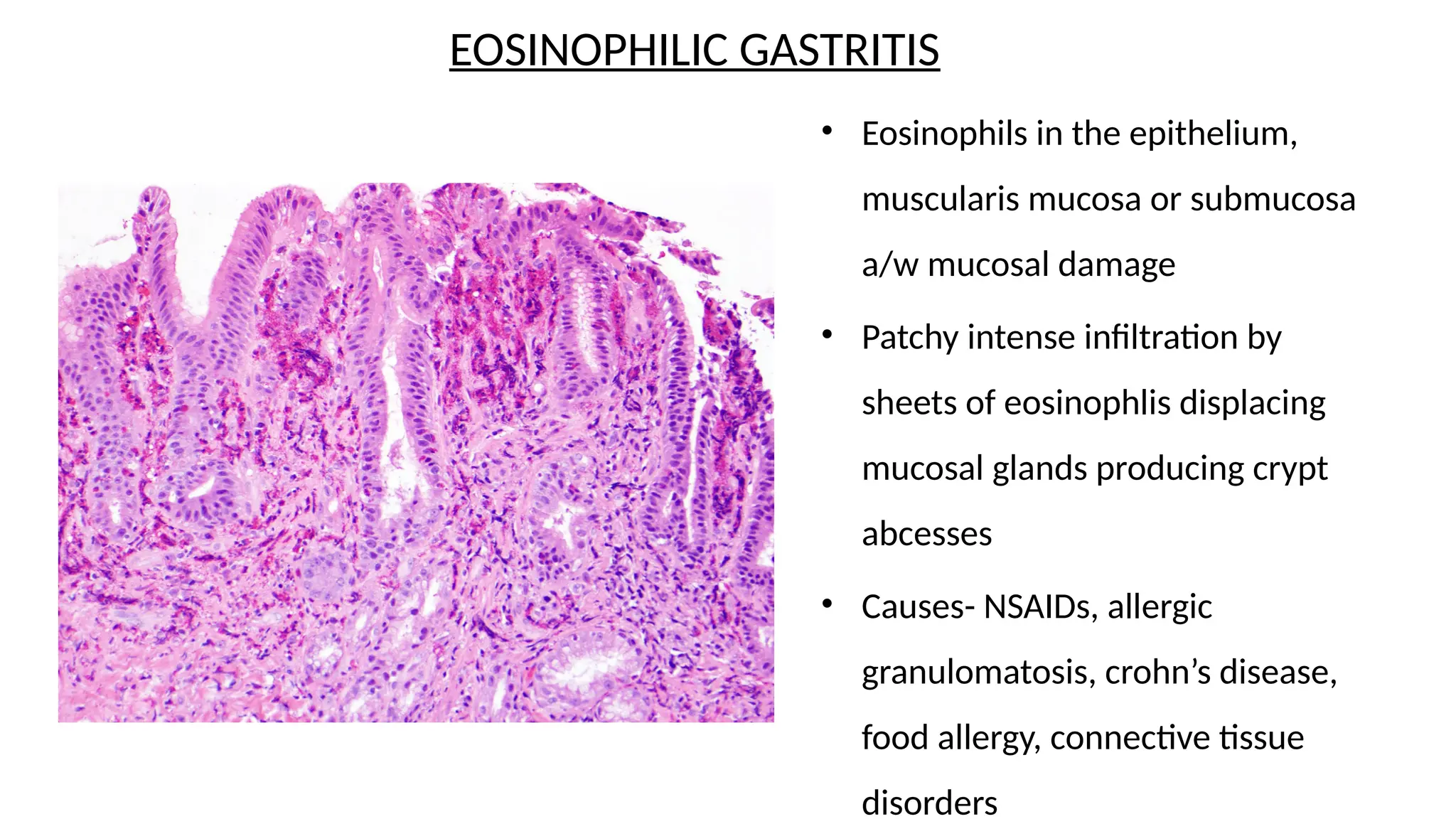 PROCESSING OF ENDOSCOPIC BIOPSIES AND THEIR INTERPRETATION, WITH ...