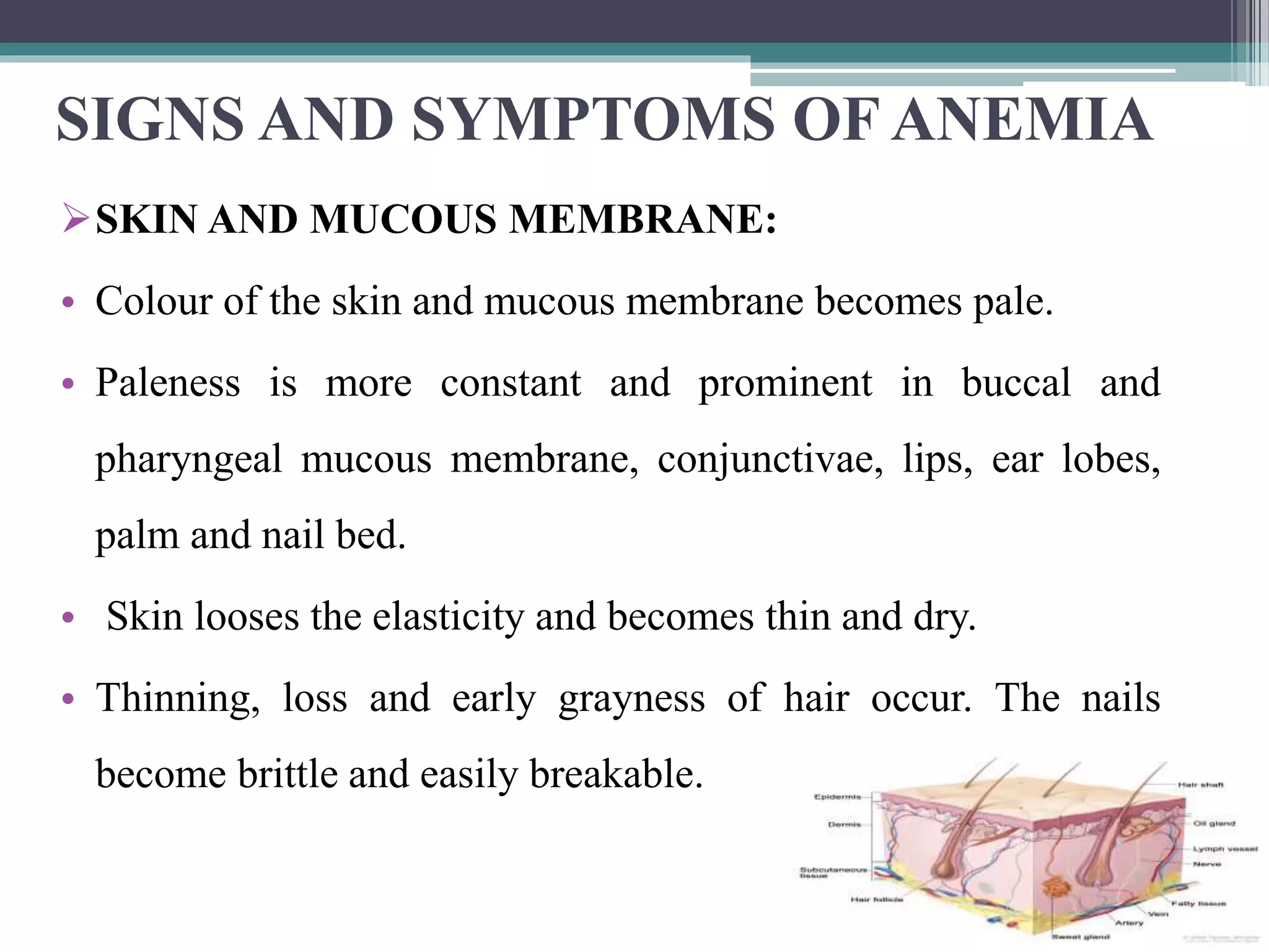 anemia- oral health | PPTX