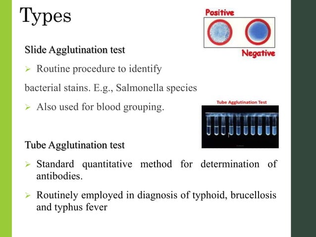 Antigen antibody systems | PPTX