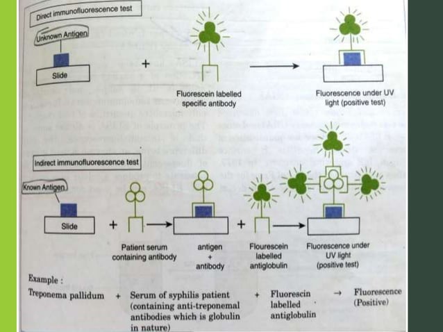 Antigen antibody systems | PPTX