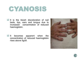 Symptomatology | PPTX