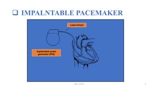 Seminar cardiac pacemaker | PPTX