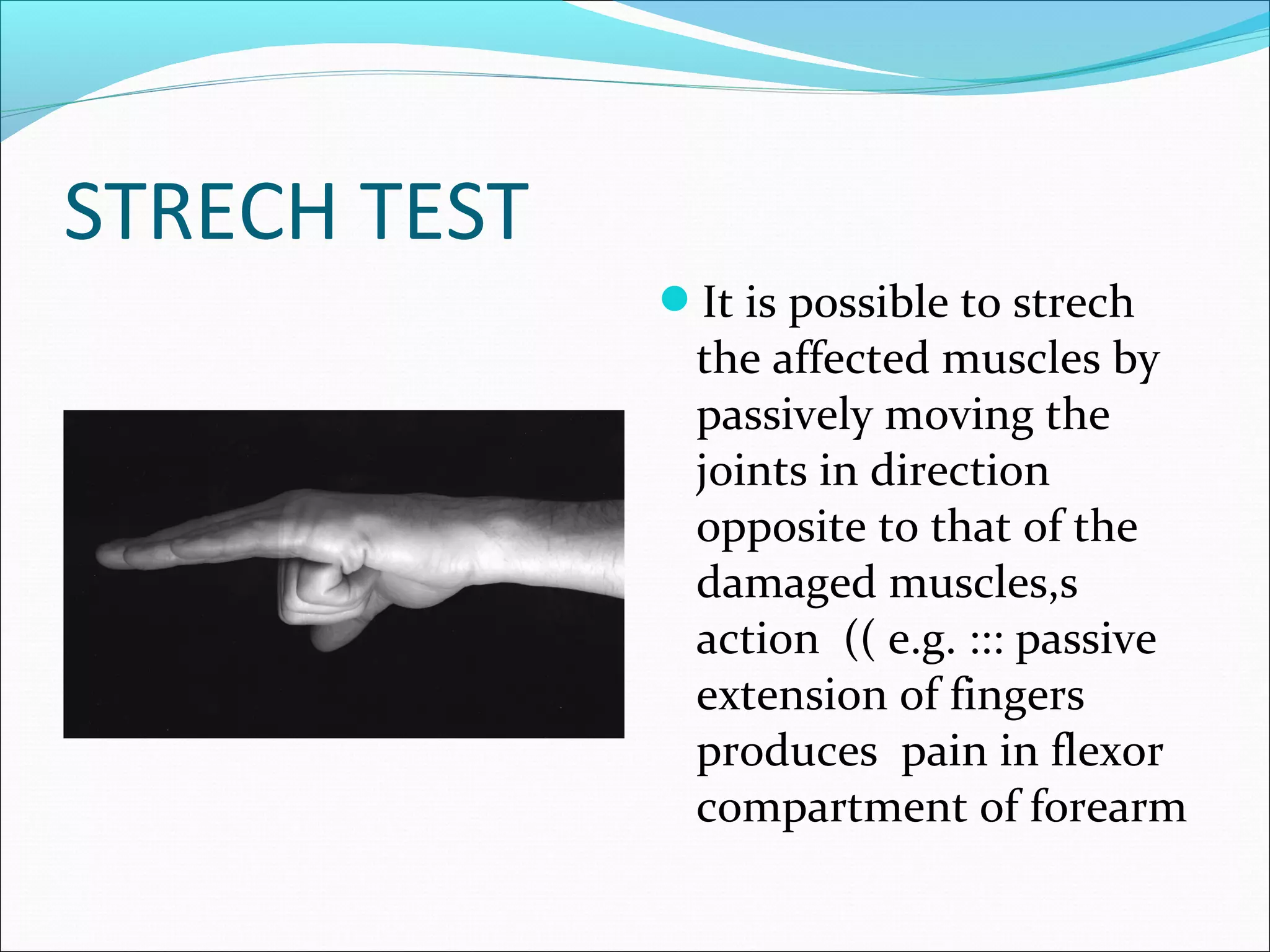 compartment syndrome | PPT
