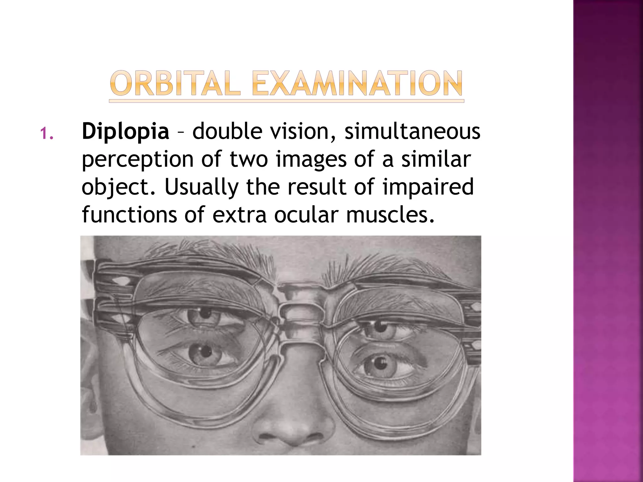 Examination of eyes | PPTX