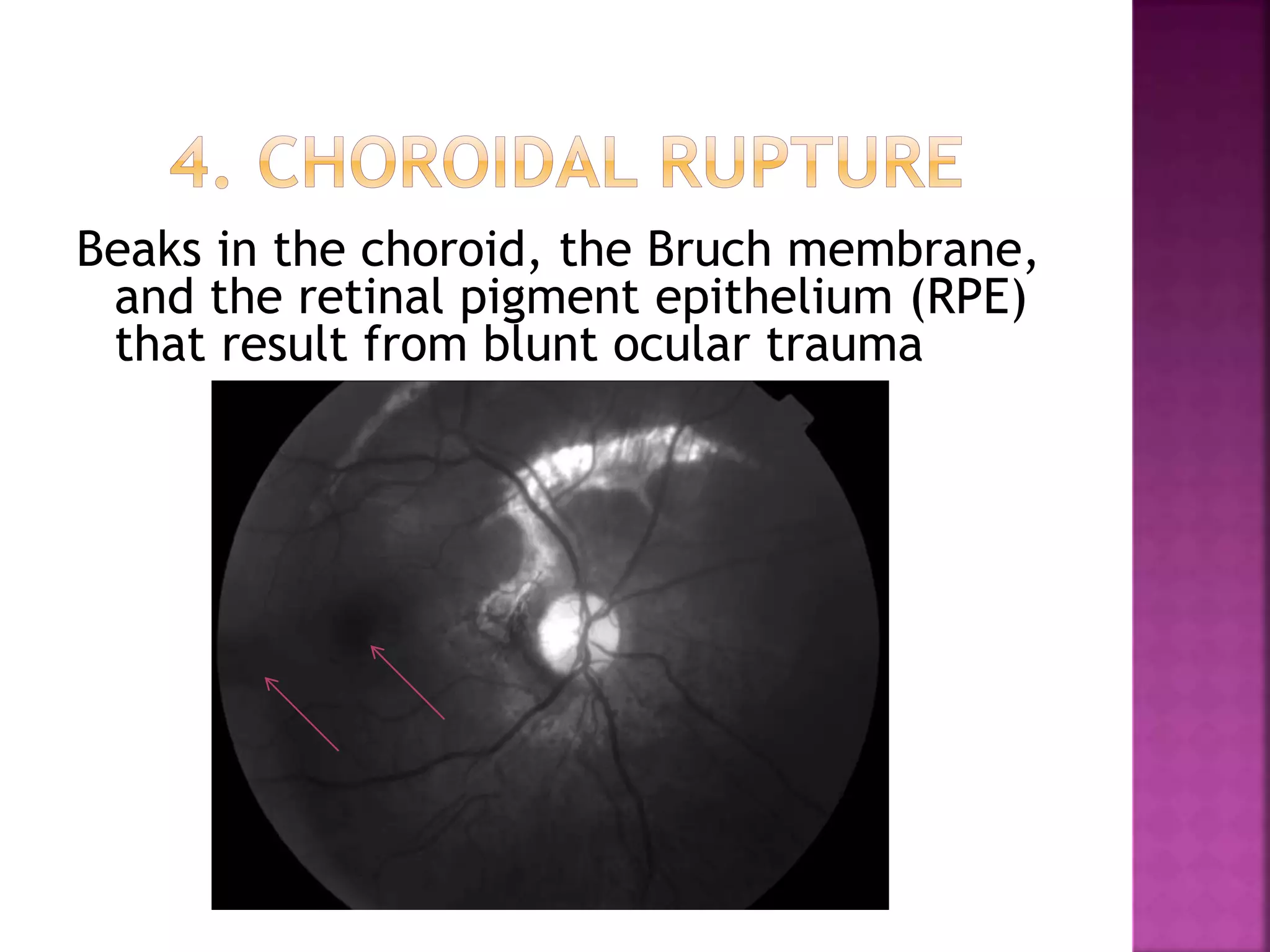 Examination of eyes | PPTX