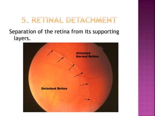 Examination of eyes | PPTX
