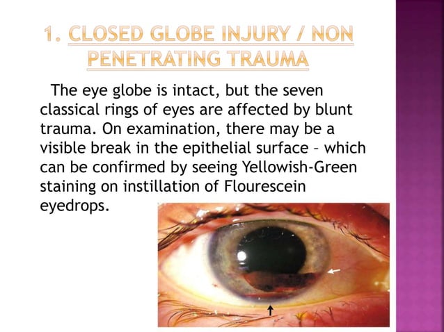 Examination of eyes | PPTX | Death, Injury, or Military Conflict ...