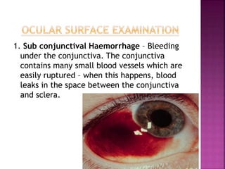 Examination of eyes | PPTX
