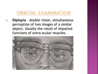 Examination of eyes | PPTX