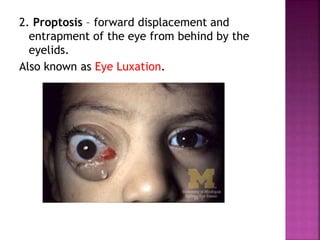 Examination of eyes | PPTX
