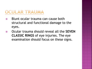 Examination of eyes | PPTX