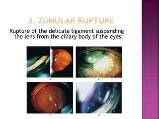 Examination of eyes | PPTX