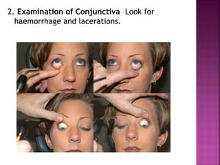 Conjunctiva Inspection