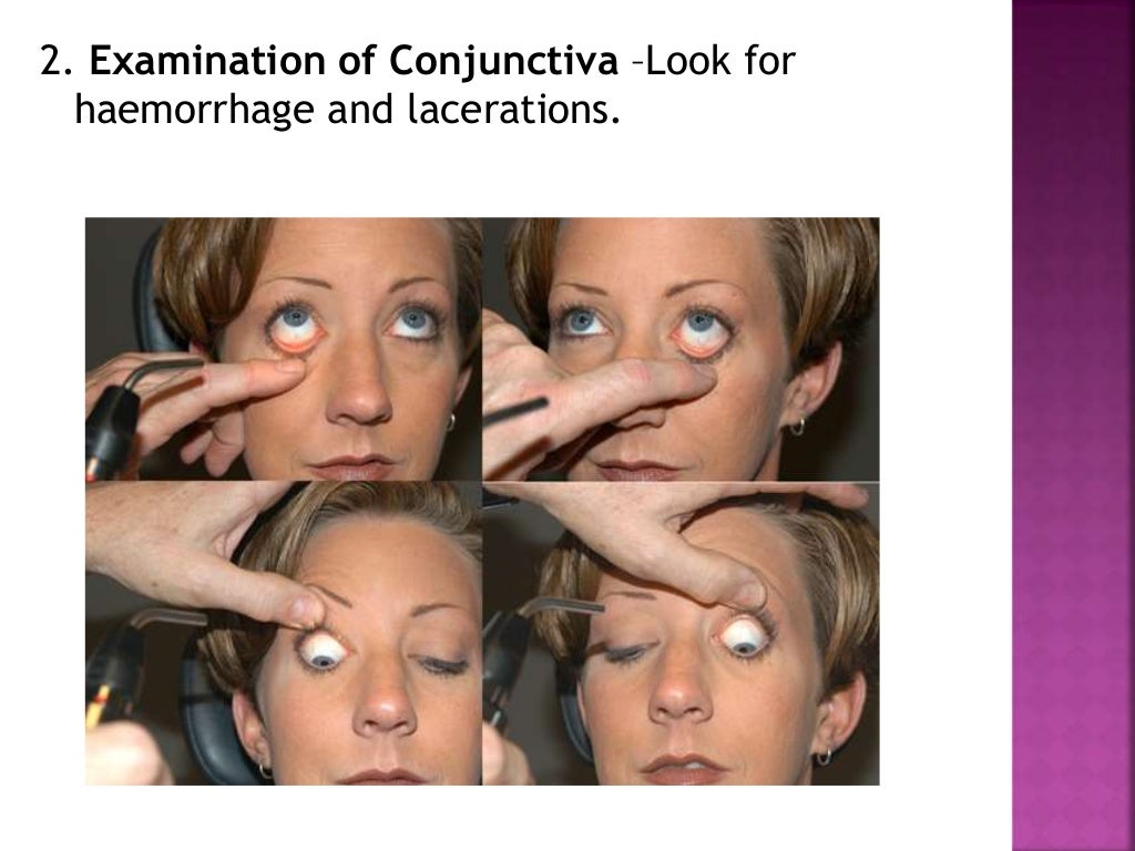 Examination of eyes