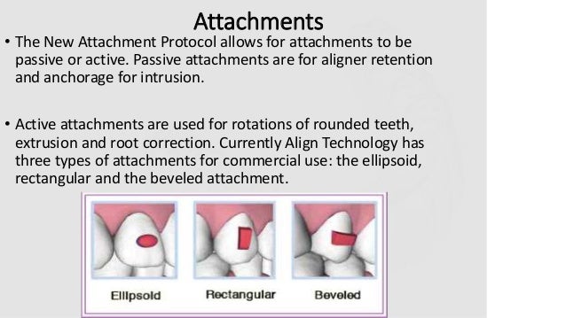 Seminar clear aligner 1