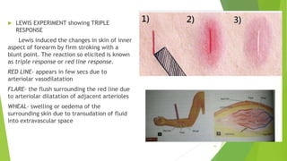 Inflammation in dentistry-SEMINAR | PPTX
