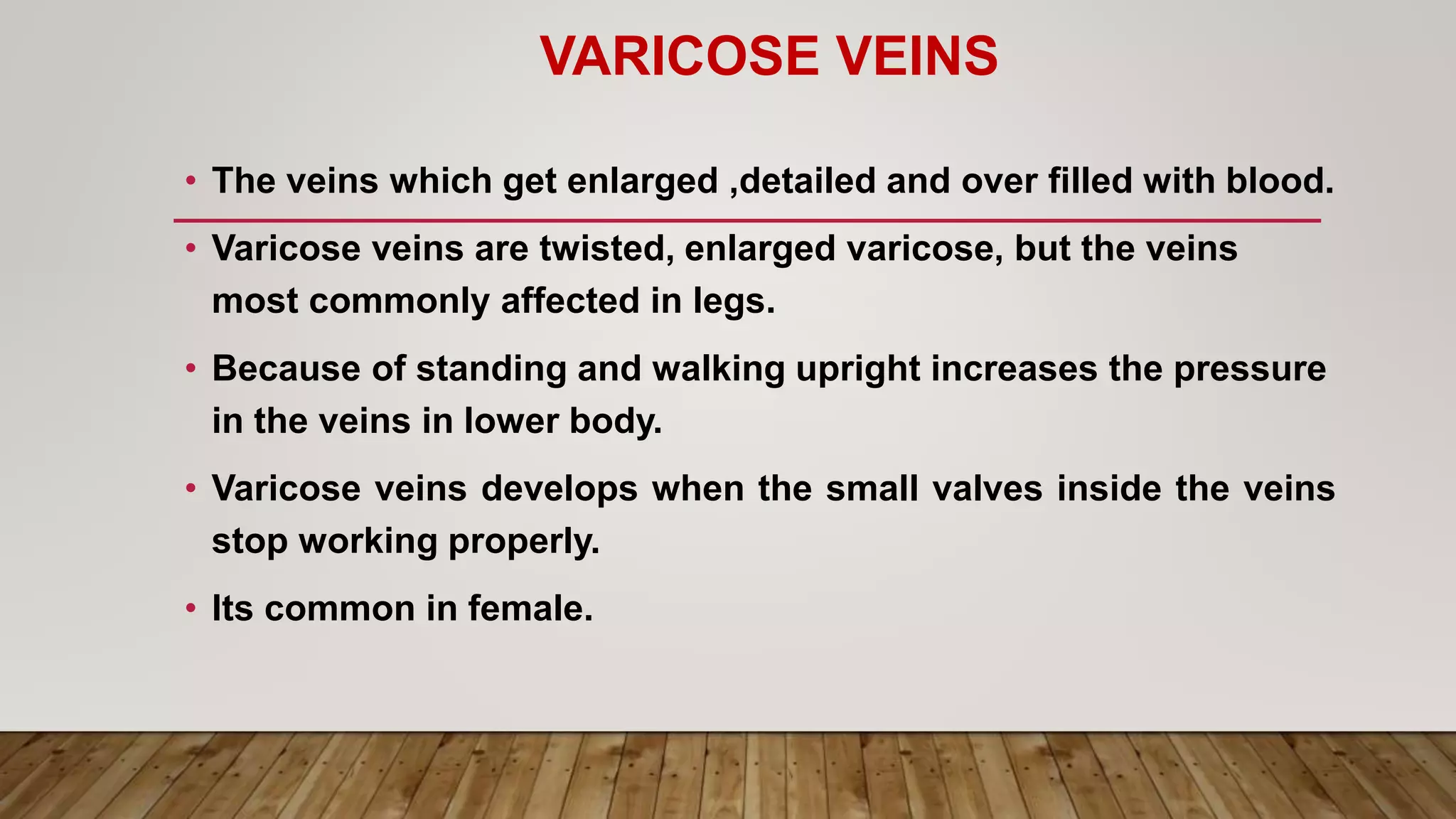 VARICOSE VEINS | PPT