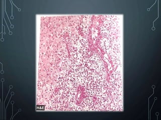 Necrosis ; Pathology ; MBBS Topic ; Seminar Topic ; Cell Death by ...