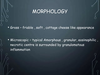 Necrosis ; Pathology ; MBBS Topic ; Seminar Topic ; Cell Death by ...