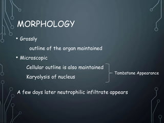 Necrosis ; Pathology ; MBBS Topic ; Seminar Topic ; Cell Death by ...