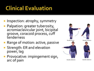 Seminar rotator cuff | PPTX