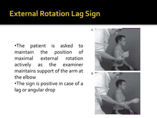 Seminar rotator cuff | PPTX