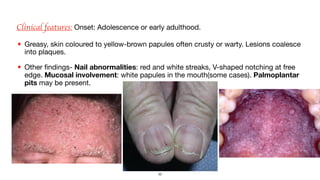 Vesiculobullous lesions of skin including intraepidermal and ...