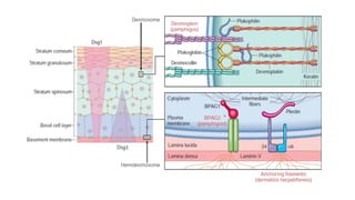 Vesiculobullous lesions of skin including intraepidermal and ...