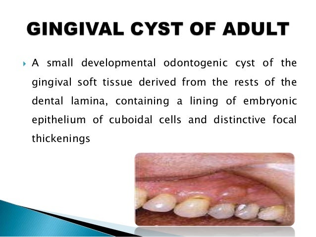 ODONTOGENIC CYSTS