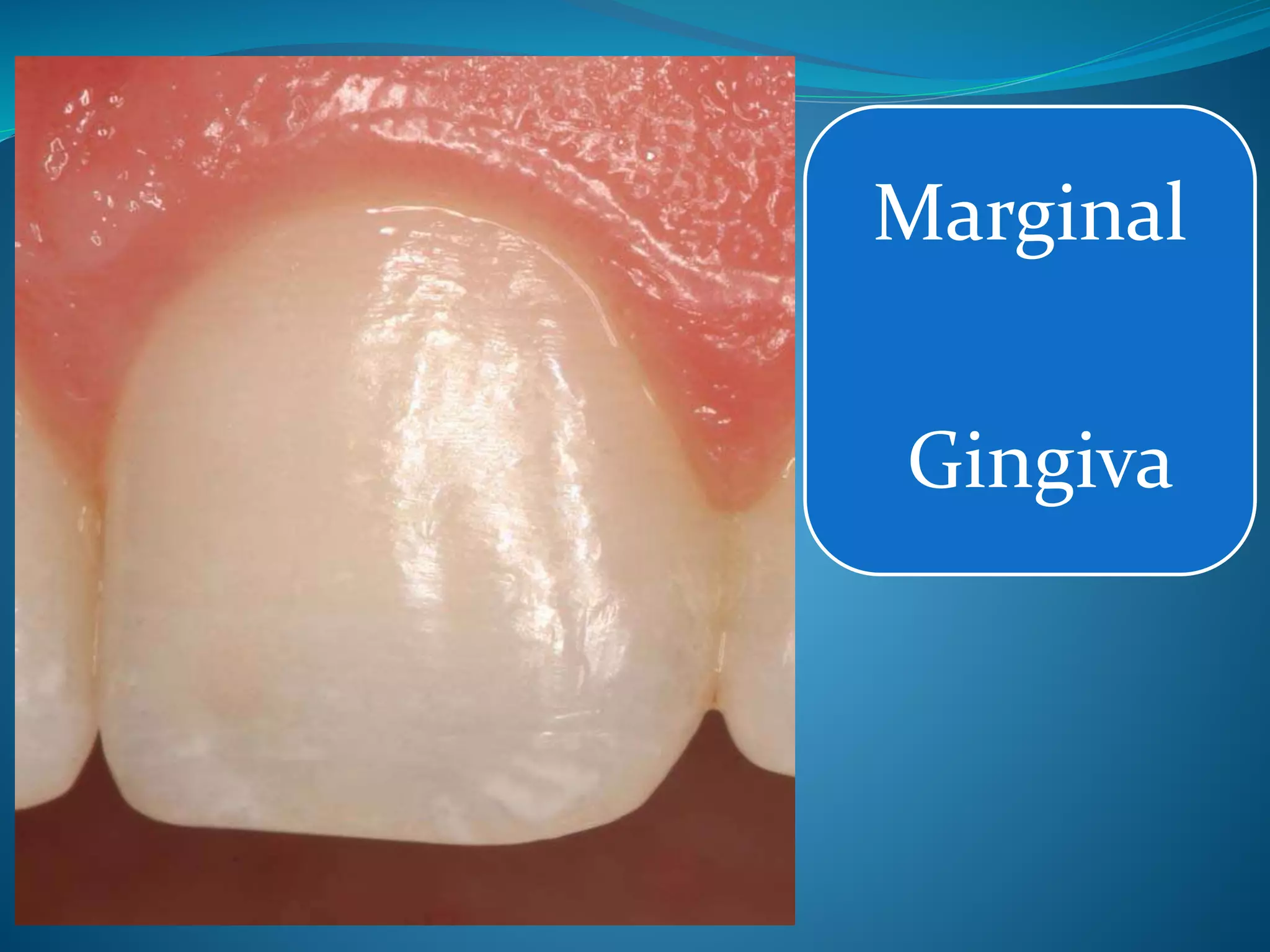 Gingiva Macroscopic Features | PPTX