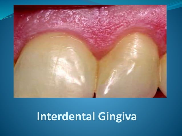 Gingiva Macroscopic Features | PPTX