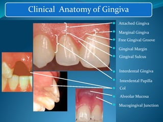 Gingiva Macroscopic Features | PPT