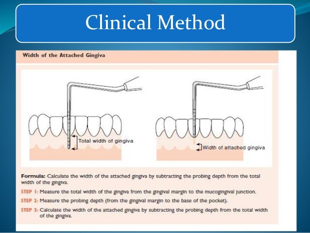 Gingiva Macroscopic Features