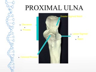 Distal humerus fracture and elbow dislocation | PPT