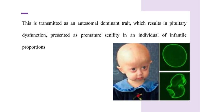 radiographic manifestations of endocrine disorders.pptx