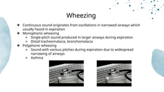 Acute Respiratory Infections in Children .pptx