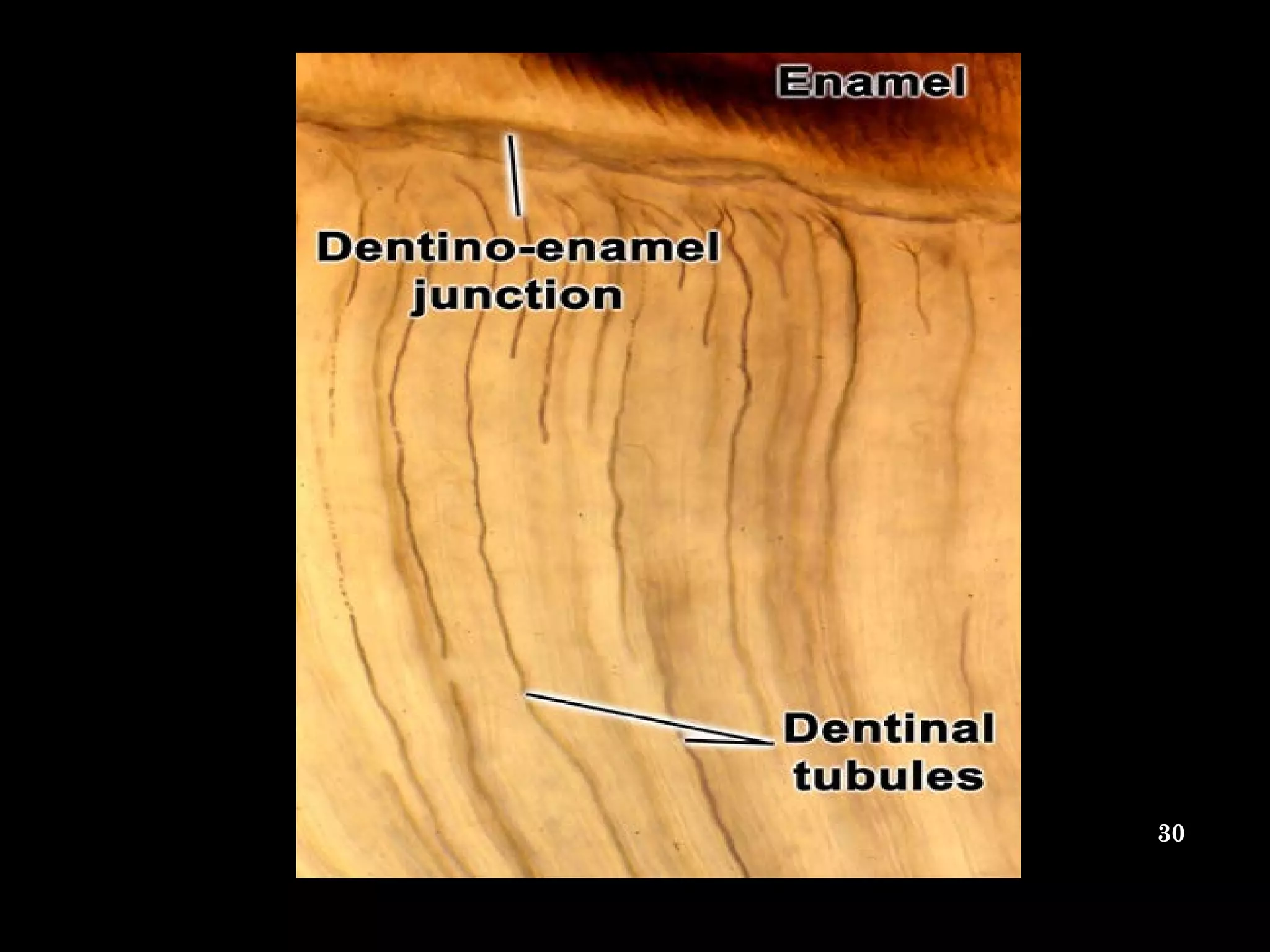 Dentin | PDF | Dental Health | Diseases and Conditions