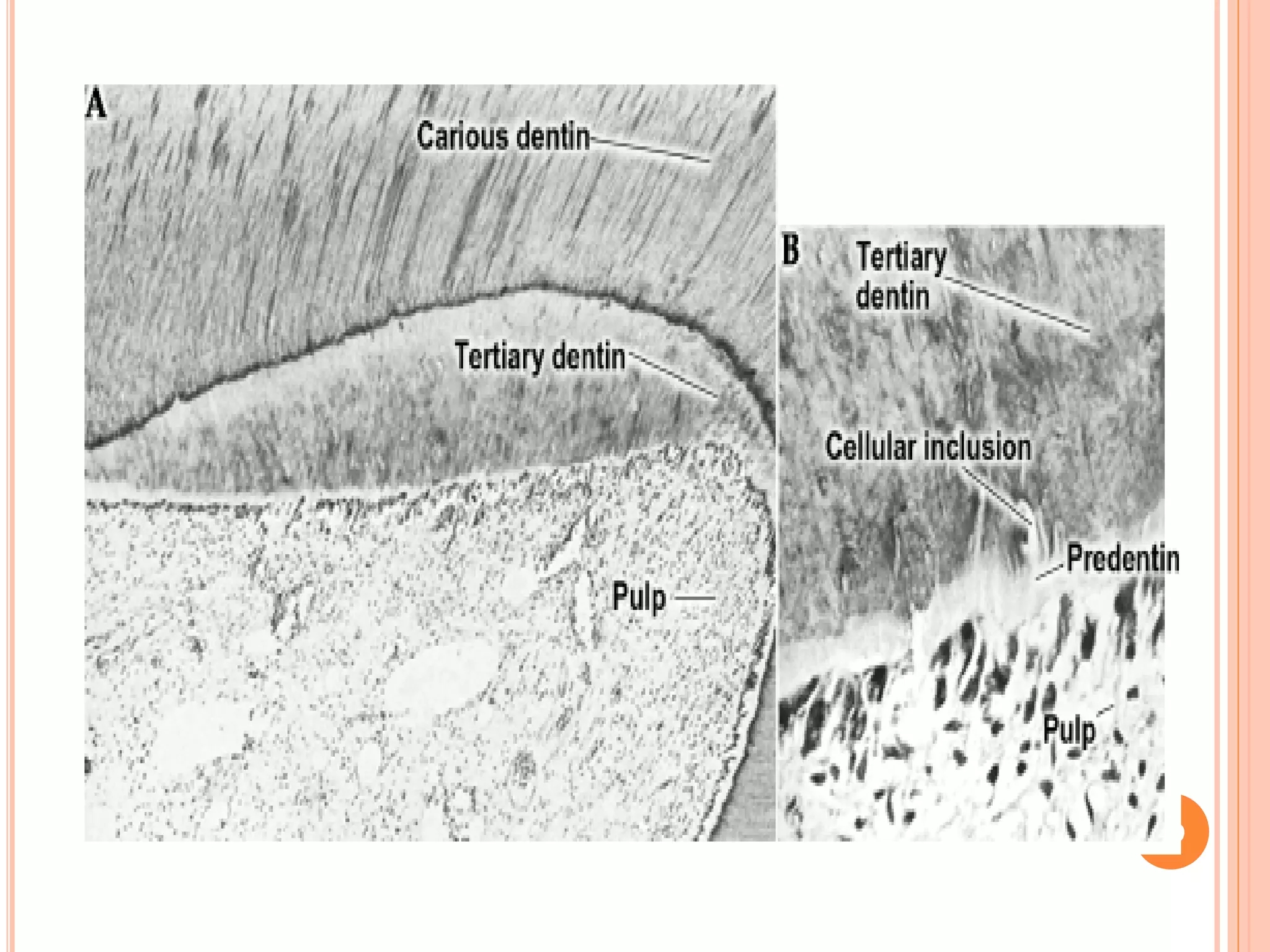 Dentin | PDF | Dental Health | Diseases and Conditions