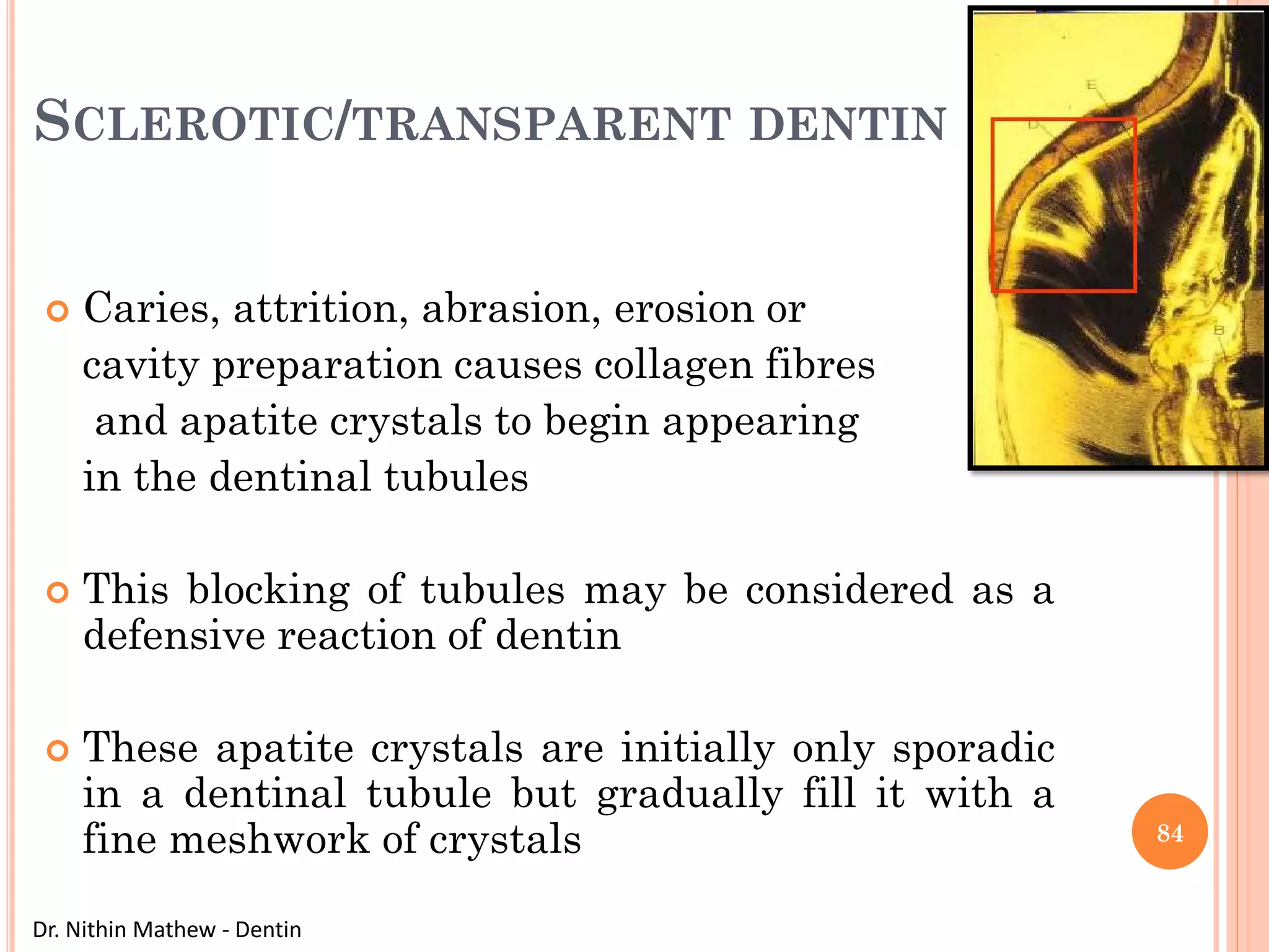Dentin | PDF