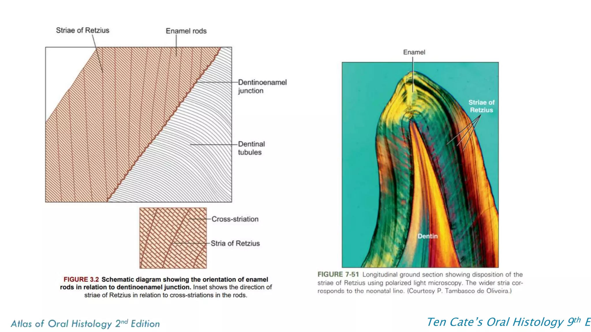 Enamel Rods and its implications | PPT