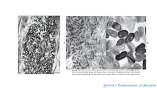Enamel Rods and its implications | PPT