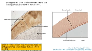 Enamel Rods and its implications | PPT
