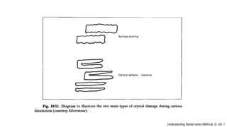Enamel Rods and its implications | PPT