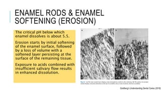 Enamel Rods and its implications | PPT