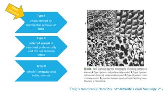 Enamel Rods and its implications | PPT
