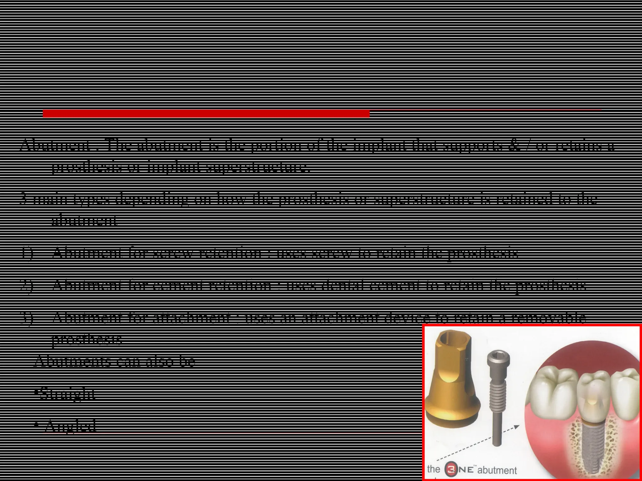 seminar 10 - DENTAL IMPLANTS- SURGICAL ASPECT, IMPLANT FAILURE (1).ppt